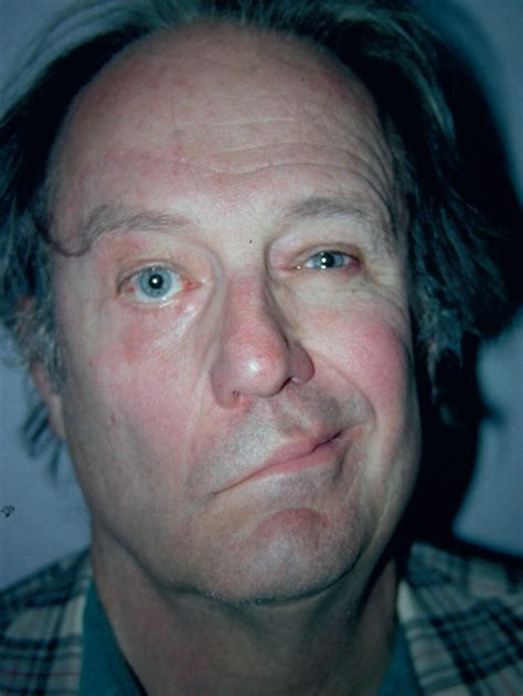 Facial Paralysis Clinical Tree