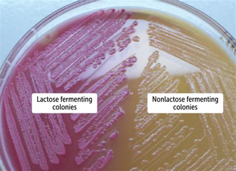 escherichia coli and the enterobacteriaceae flashcards quizlet