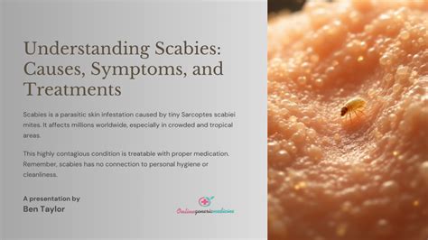 Ppt Understanding Scabies Causes Symptoms And Treatments