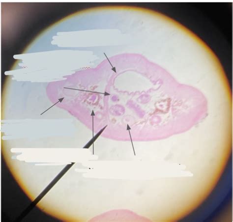 Leech Cross Section Diagram Quizlet