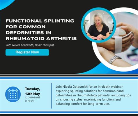 👉 Functional Splinting For Common Deformities In Rheumatoid Arthritis
