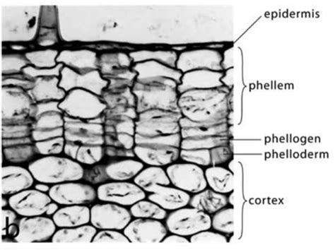 Patho Final Flashcards Quizlet Patho Final Flashcards Quizlet