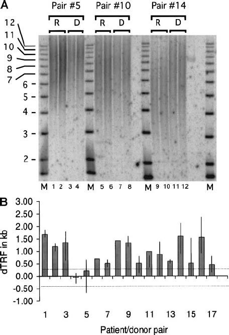 Terminal Restriction Fragment Length Analysis On Granulocyte Dna The Download Scientific
