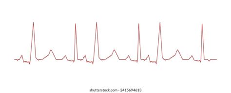 최고의 Ecgchart 로열티 프리 이미지 및 스톡 사진 Shutterstock