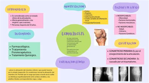 Gonartrosis Selva Yazbeth Espinoza Villavicencio Udocz