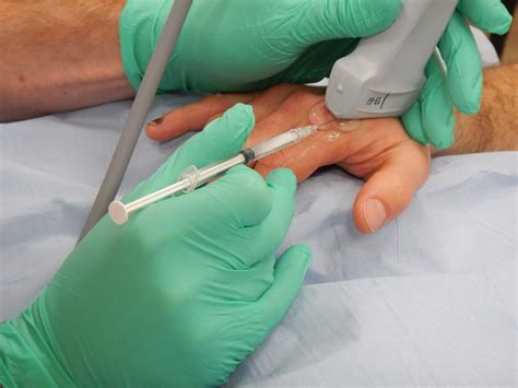 Can Steroid Injections Help With Frozen Shoulder