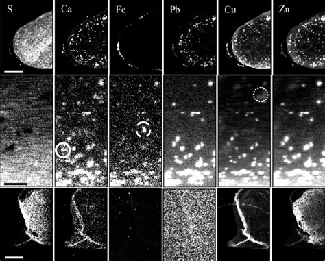 Synchrotron Xrf Maps Of A Distal Top And Center Indicated In Figure Download Scientific