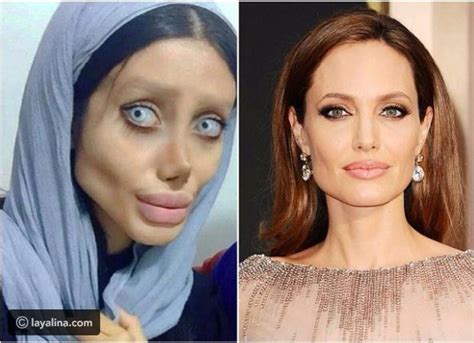 إيرانية تخضع لـ50 عملية تجميل لتبدو مثل أنجلينا جولي وهكذا أصبح شكلها