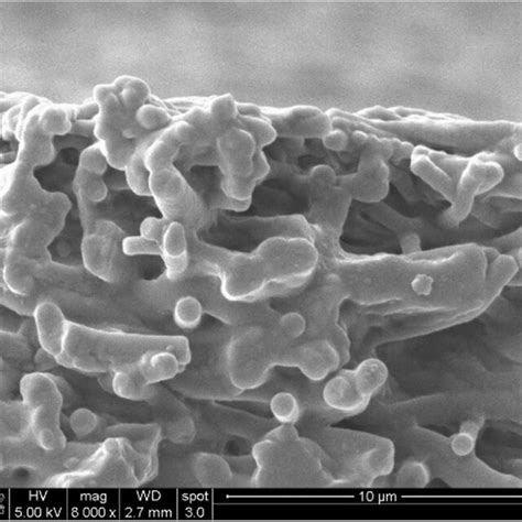 A Cross Section Of A Single Leaflet Was Imaged Using Scanning Electron