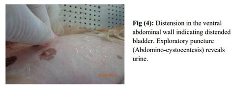 Tube Cystostomy Vs Bladder Marsupialization Clinical And