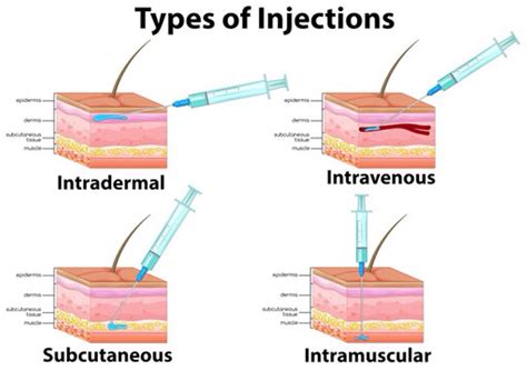 Best 13 Types Of Injection Artofit