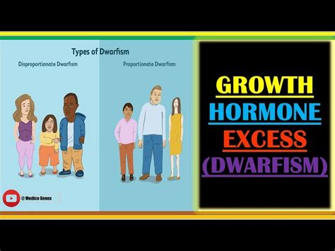 Disproportionate Dwarfism
