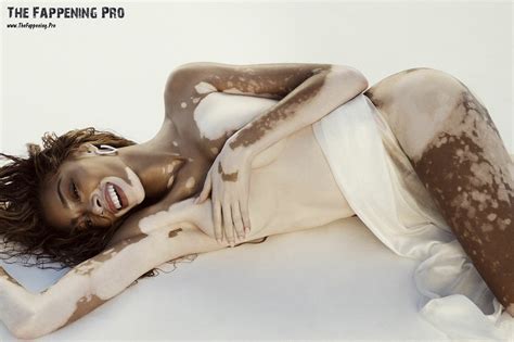 Winnie Harlow Naked For Womens Health 8 Photos The Fappening