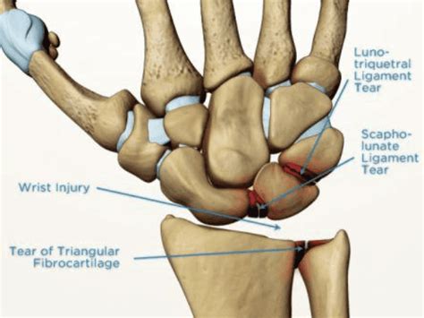 Triangular Ligament