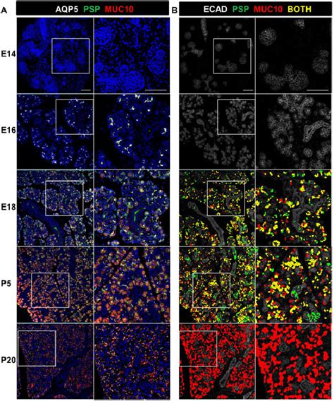 Quantitative Spatio Temporal Analysis Of Secretory Acinar Cell Download Scientific Diagram