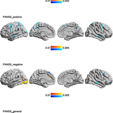 The Cortical Regions Showing A Significant Correlation With The