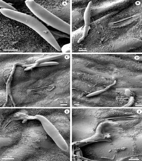 Germinação E Penetração De Stenocarpella Macrospora Em Tecido Foliar Download Scientific