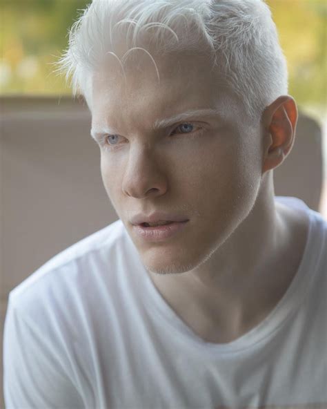 Pin De Earl James Aller Em Halloween Modelo Albino Garotas Olhos Lilas