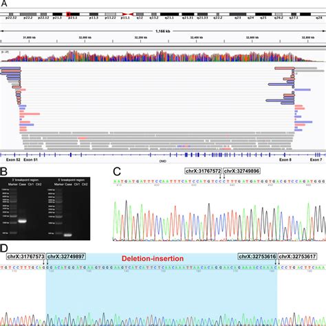 identification and validation of the complex structural variant in dmd