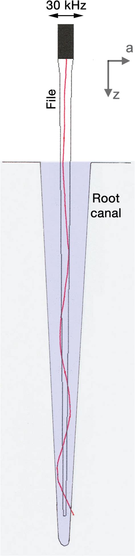 Acoustic Streaming Induced By An Ultrasonically Oscillating Endodontic File The Journal Of The