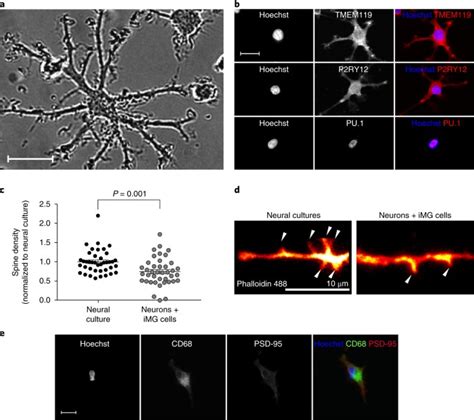Steven Sheridan On Linkedin Increased Synapse Elimination By Microglia In Schizophrenia…