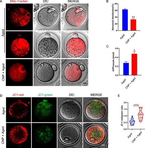 Figures And Data In C Type Natriuretic Peptide Improves Maternally Aged Oocytes Quality By