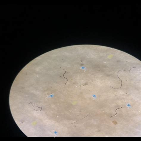 Microplastics Object Detection Dataset By Iam