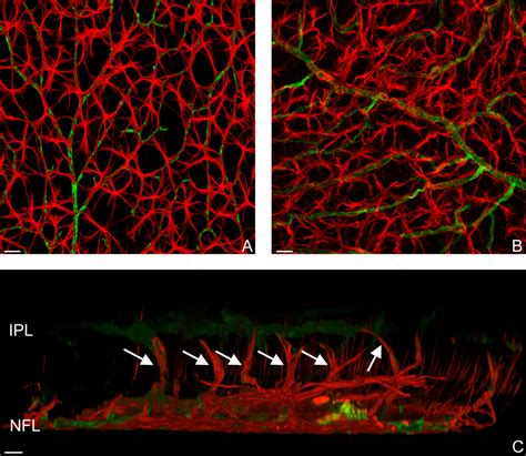 Astrocyte Reactivity And Plasticity Gabe Luna