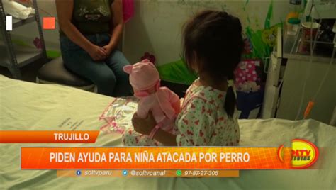 Trujillo Madre Pide Ayuda Para Ni A Atacada Por Perro Soltv Peru