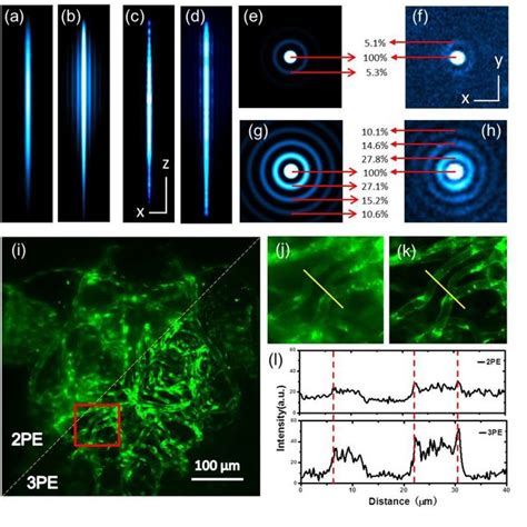 Pdf Rapid Volumetric Imaging With Bessel Beam Three Photon Microscopy