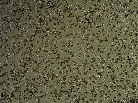 Trichoderma Beneficial Microbes