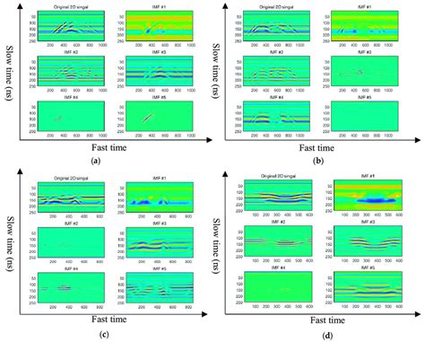 Four Different Types Of Human Motion 2d Echo Signals And Several Bimf
