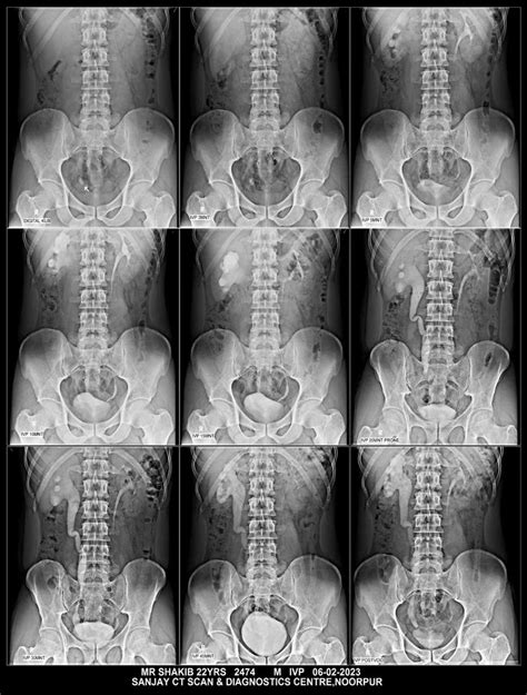 Canon Inkjet X Ray Printer With Dicom Software At ₹ 30000 In Hasanpur Id 2851275778533