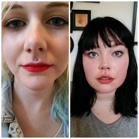 Medusa Piercing Taken Out