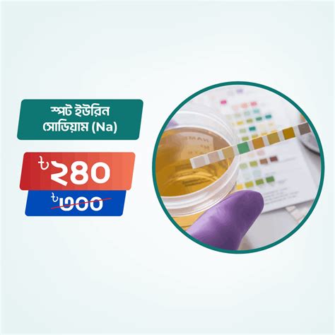 Spot Urine Sodium Na Arogga Online Lab