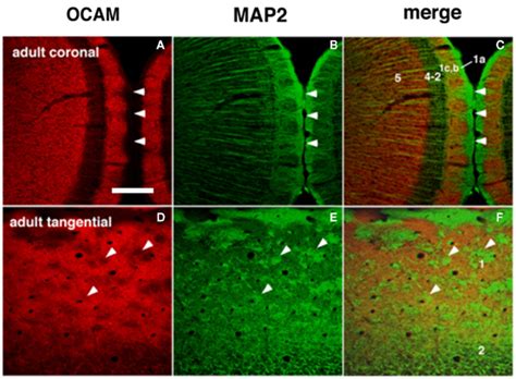 Frontiers Small Scale Module Of The Rat Granular Retrosplenial Cortex An Example Of The
