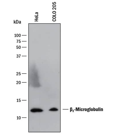 Human Beta 2 Microglobulin Antibody Mab8248 Randd Systems