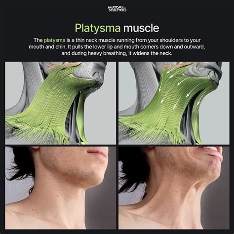 Anatomy For Sculptors Platysma Muscle