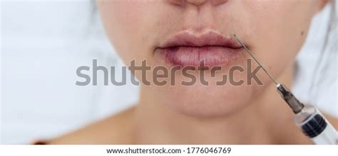 Injection Swelling Photos And Images And Pictures Shutterstock
