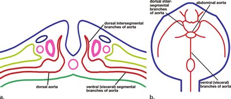 Schematic Illustrations Of Embryologic Development Of The Aorta And