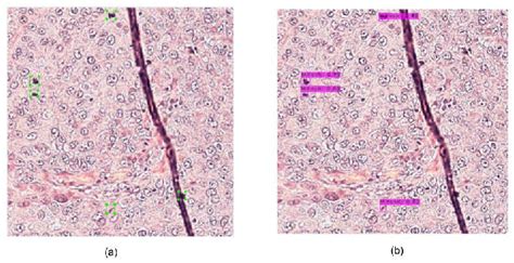 Figure 1 From Mitotic Nuclei Detection In Breast Histopathology Images Using Yolov4 Semantic