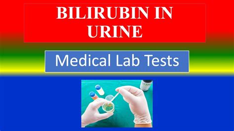 Bilirubin In Urine Test Medical Lab Tests What Is Uses Need Preparation Results