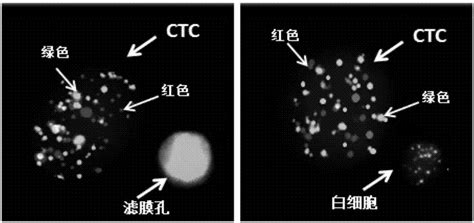 Osteosarcoma Circulating Tumor Cell Identification Kit Eureka Patsnap