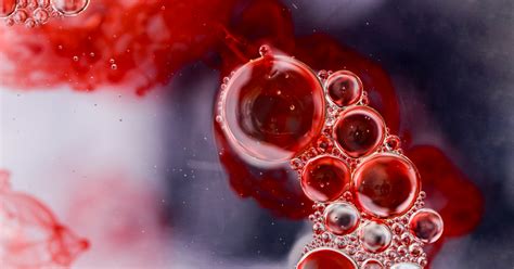 In Support Of A Hemophiliac Advocate New Straits Times