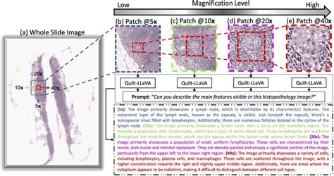 mohammed bennamoun on linkedin check this cvpr 2025 paper below if interested in histopatholgy …