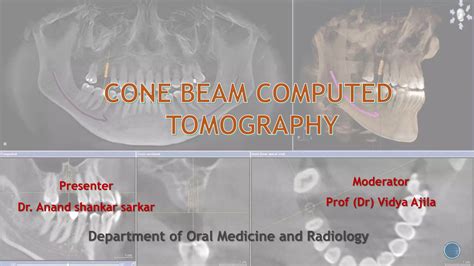 Cone Beam Computed Tomography Pptx