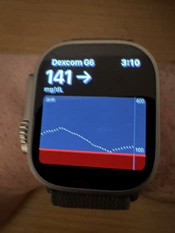Dexcom G6 App And Complication Working On Apple Watch Ultra MacRumors Forums