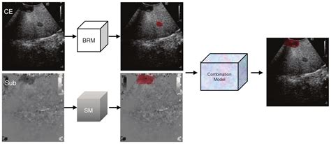 Journal Of Hepato Biliary Pancreatic Sciences Vol 32 No 1