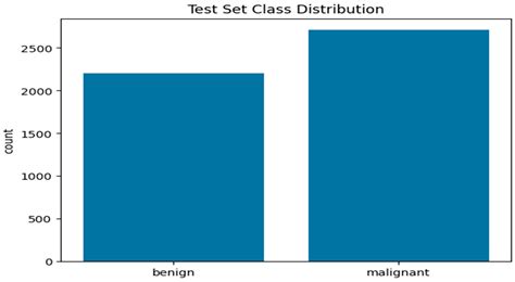 Breast Cancer Classification Using Fine Tuned SWIN Transformer Model On Mammographic Images