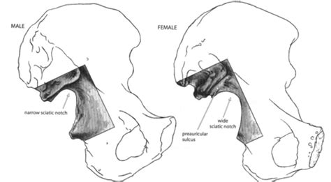 Quiz 3 For Final Sex Pelvis General Terms Flashcards Quizlet